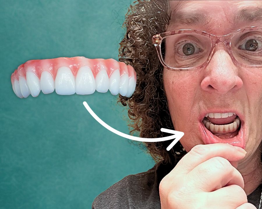 How to Choose the Best Dental Implants